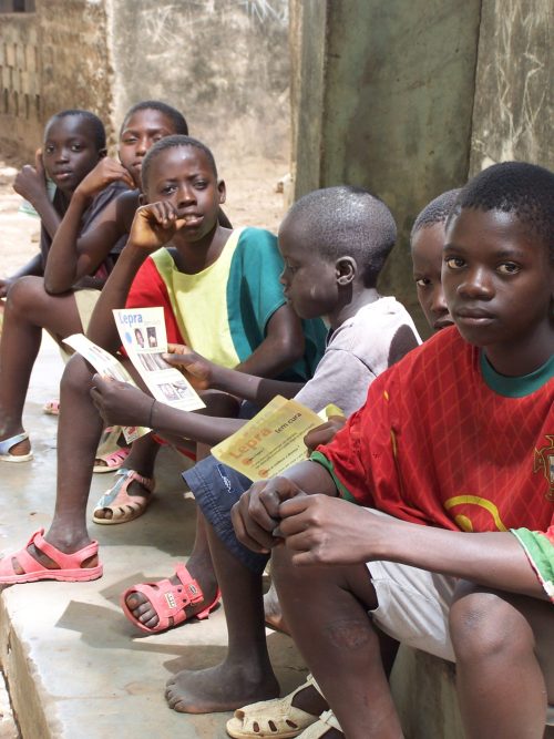 Conoscere la lebbra per eliminarla. Preoccupanti i casi di lebbra in ...